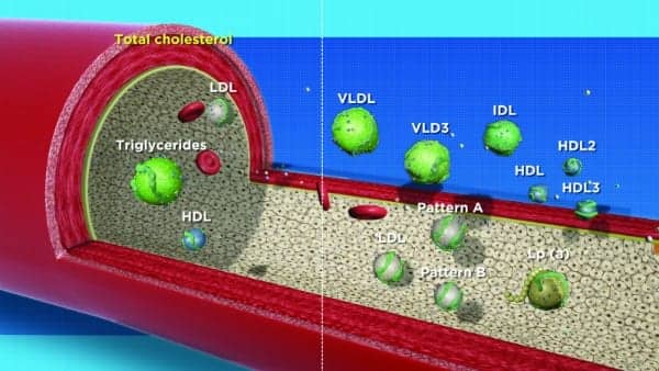 Lipid Screening for Cardiovascular Disease