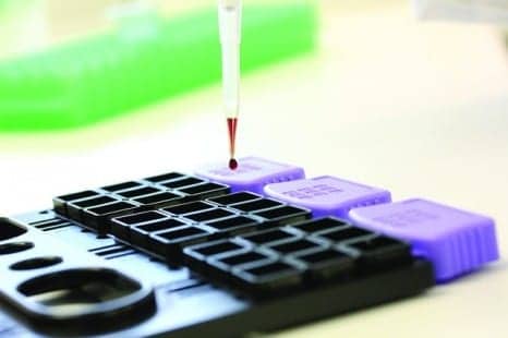 June 2016 Product Spotlight: Molecular Diagnostics | Clinical Lab Products