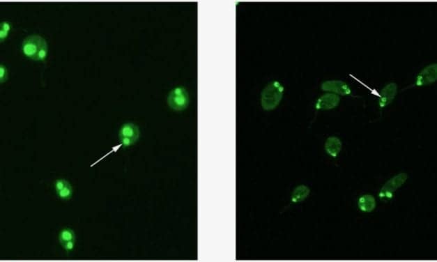 PerkinElmer - Clinical Lab Products