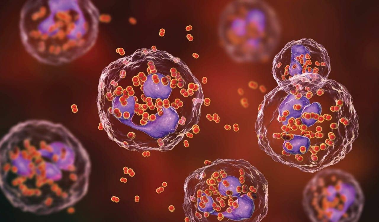 STI screening - Clinical Lab Products