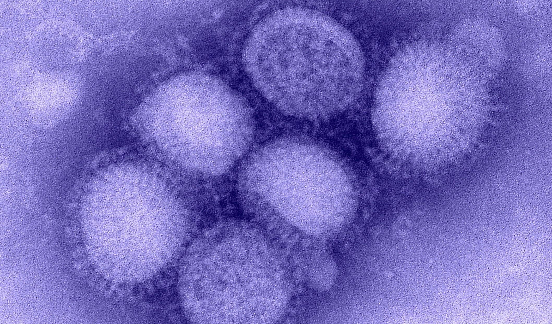 influenza - Clinical Lab Products