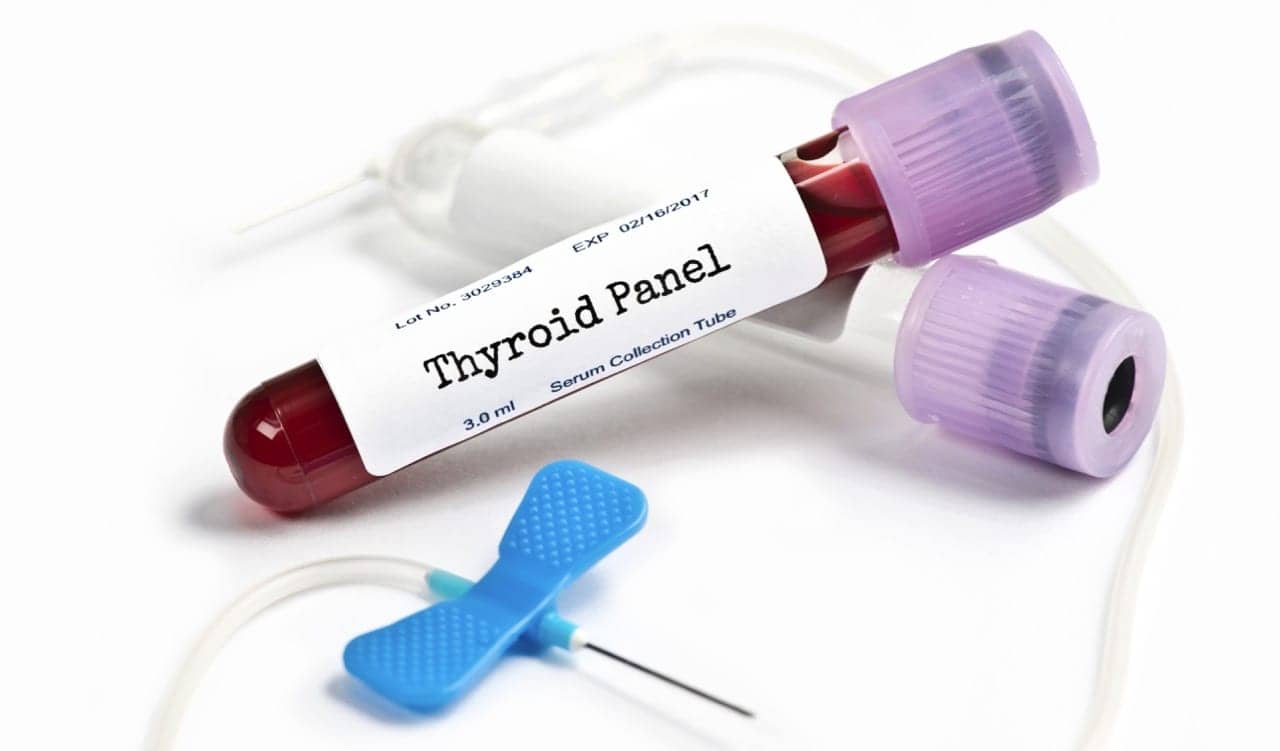 thyroid function tests
