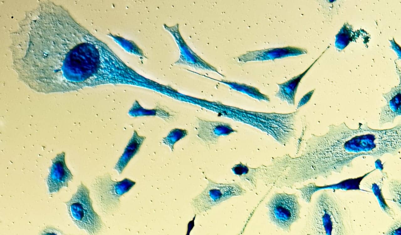 Prostate Biopsy Genomic Test