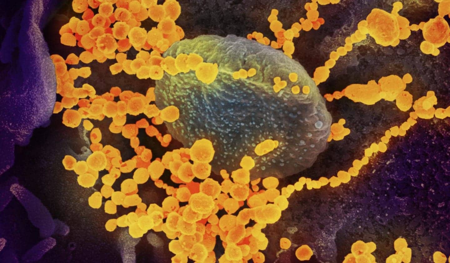 Whole Pathogen Multiplex Controls to Support Testing for Cold, Cough ...