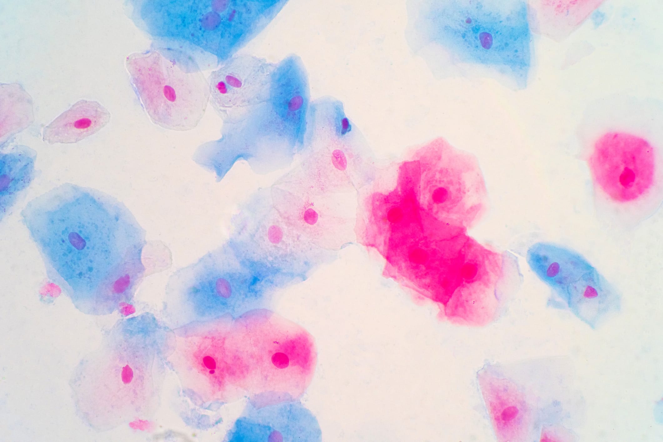 Viewpoint | Support for the Pap Test | Clinical Lab Products