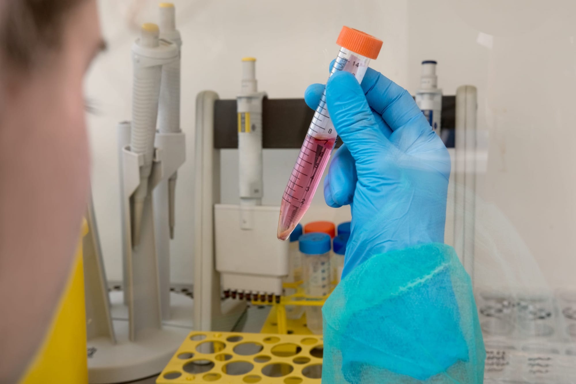 Study Details Cancer Screening Deficits Due to Pandemic | Clinical Lab ...