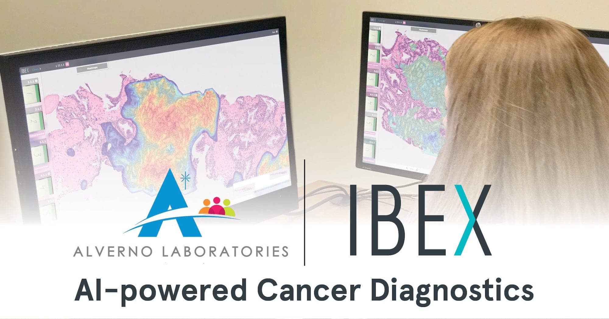 Alverno Laboratories to Deploy Ibex's AI Solution for Cancer ...