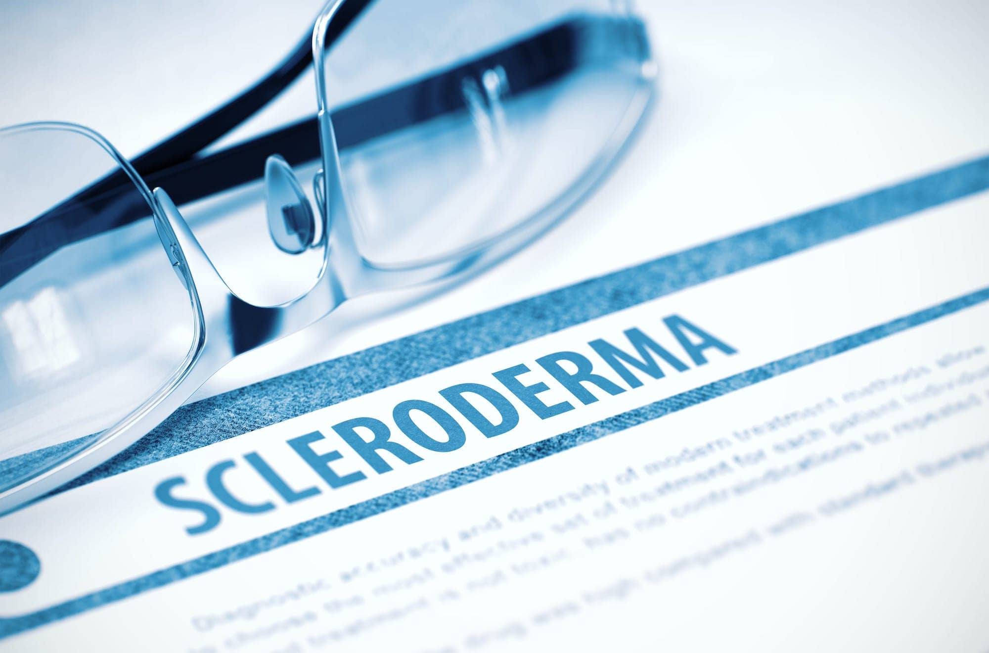 Potential Lung Disease Biomarker Discovered in Scleroderma Patients ...