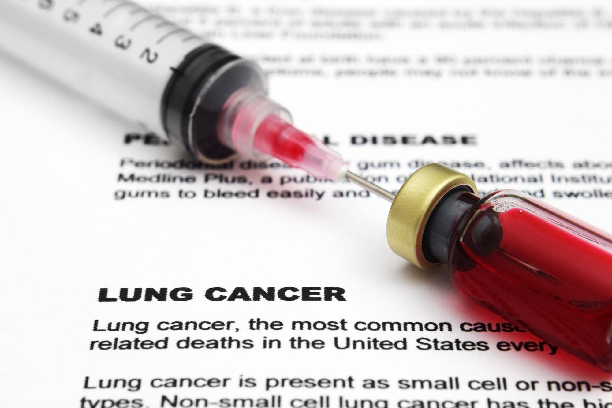 New Liquid Biopsy for Lung Cancer Has High Detection Rate | Clinical ...