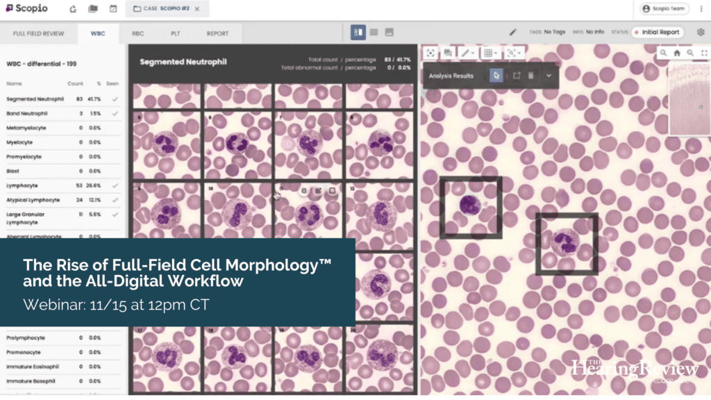 Webinar: Full-Field Cell Morphology | Clinical Lab Products