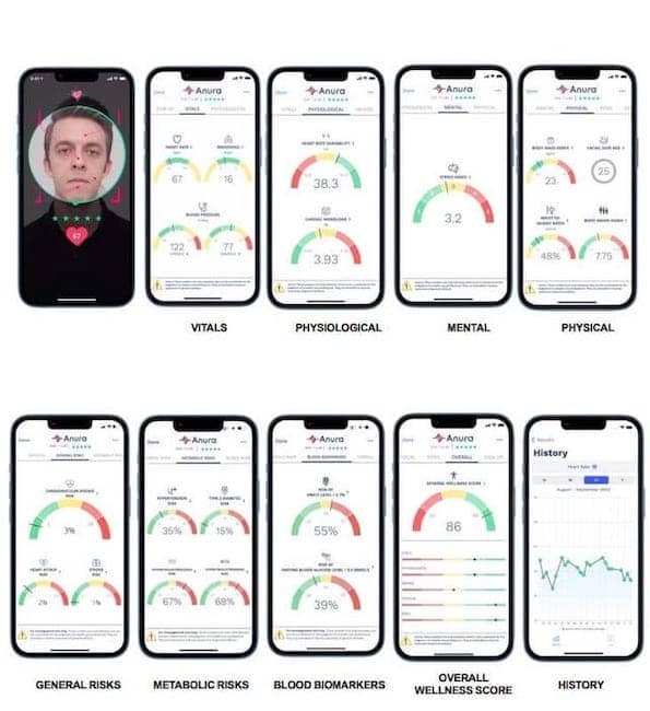 Contactless Health Monitoring Device Can Assess Disease Risk