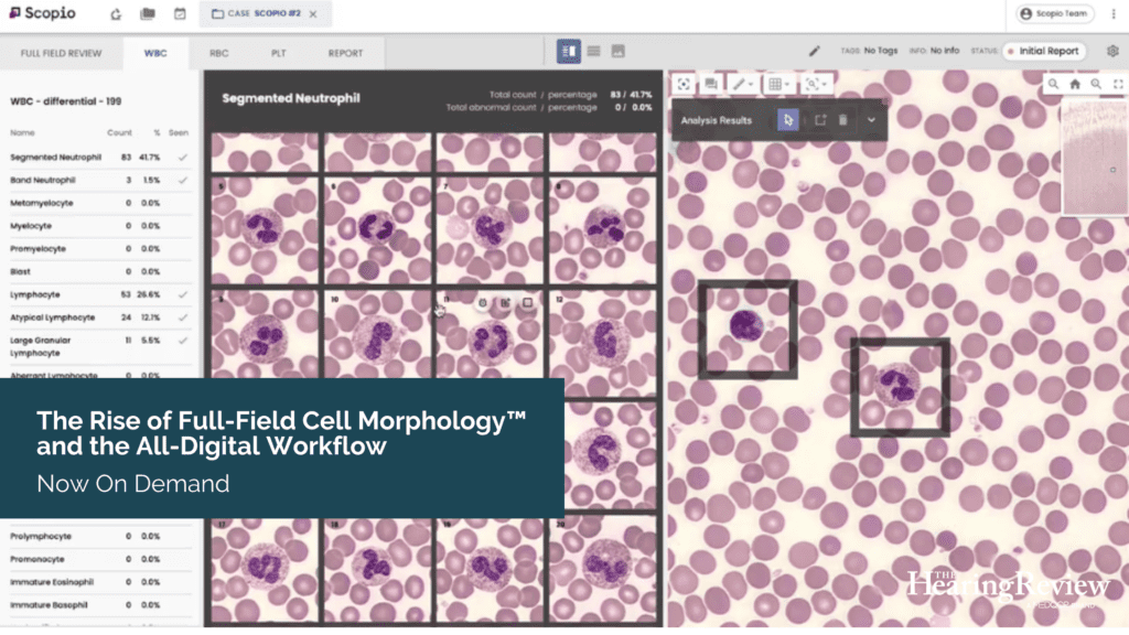 The Rise of Full-Field Cell Morphology™ and the All-Digital Workflow | Clinical Lab Products