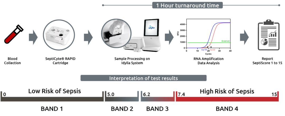 Sepsis Test Shows the Value of Rapid Diagnosis | Clinical Lab Products