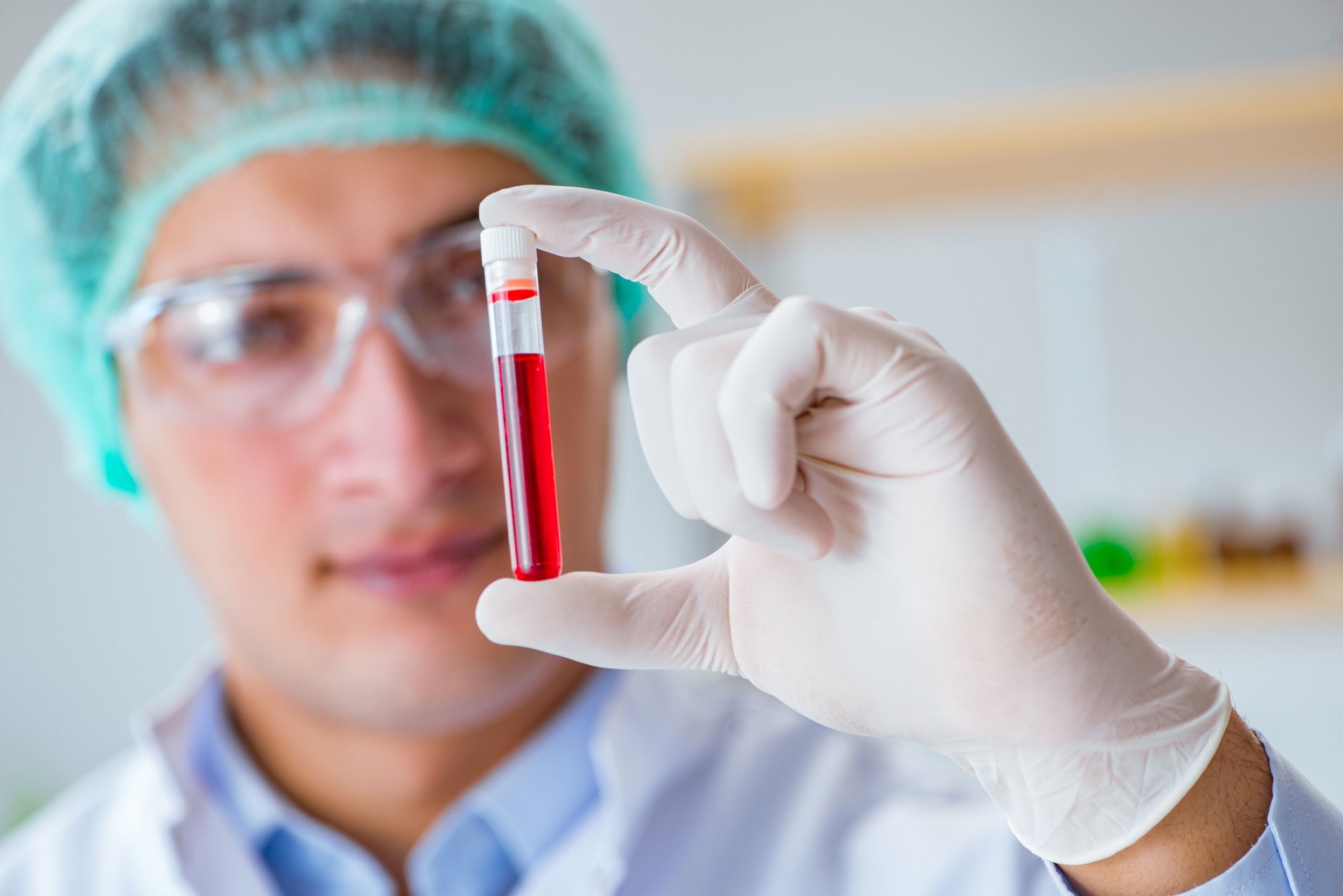 Quest Diagnostics to Develop MCaST Blood Test | Clinical Lab Products