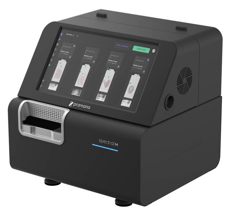 Volumetric Digital Scanning Gets AI Boost | Clinical Lab Products