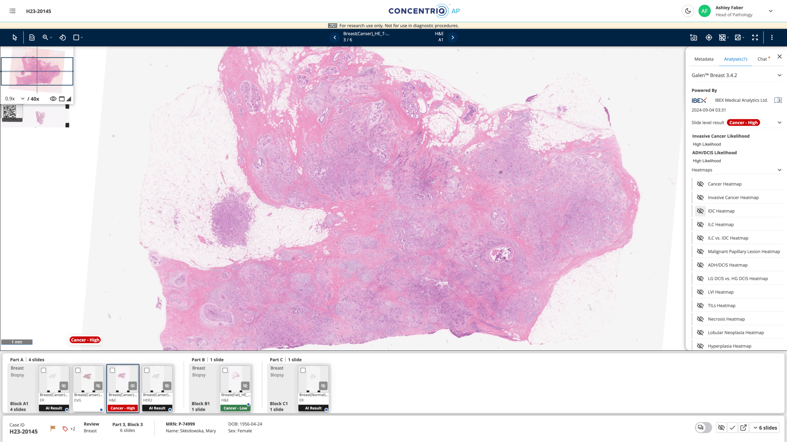 Digital Pathology Platform Delivers Immediate Efficiency Gains at P&C ...