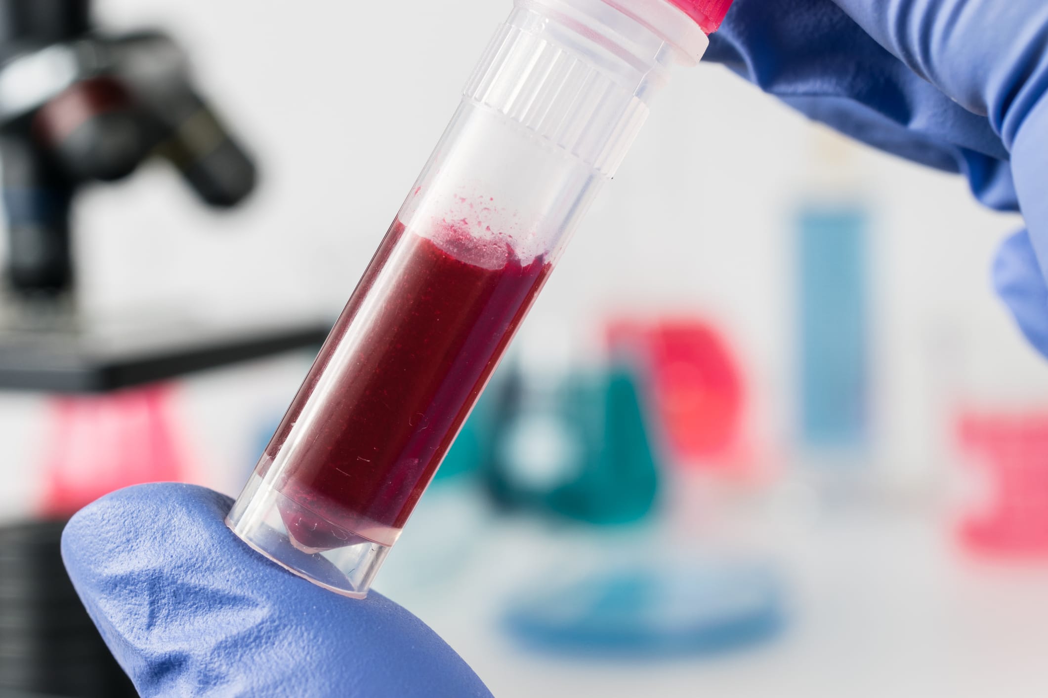 Global Trial for Blood-Based Hematology Diagnostics to Launch ...