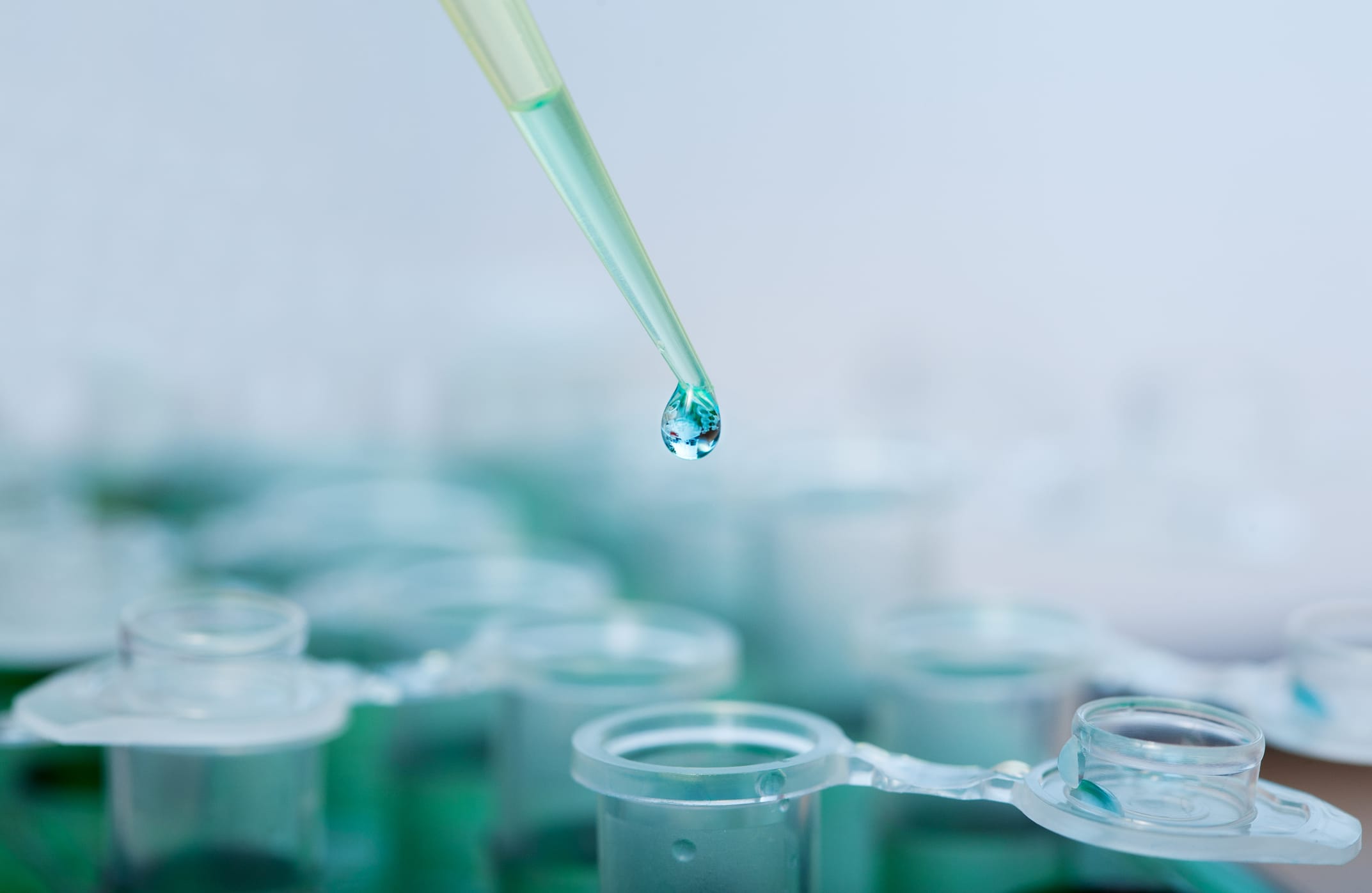 Foresight Diagnostics Reports Clinical Performance Data for ctDNA Assay in Early-Stage Lung ...