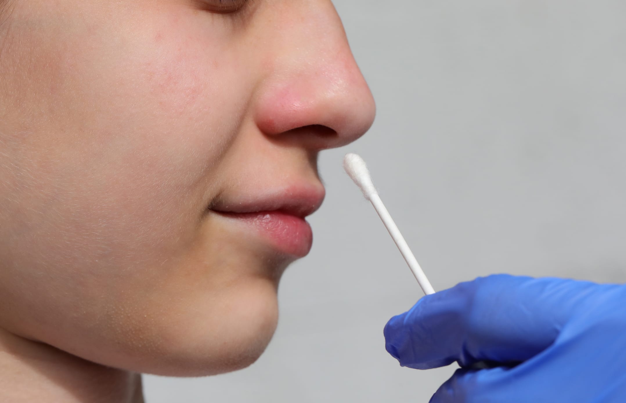 bioMérieux Receives FDA Clearance for Anterior Nasal Swab Testing on ...