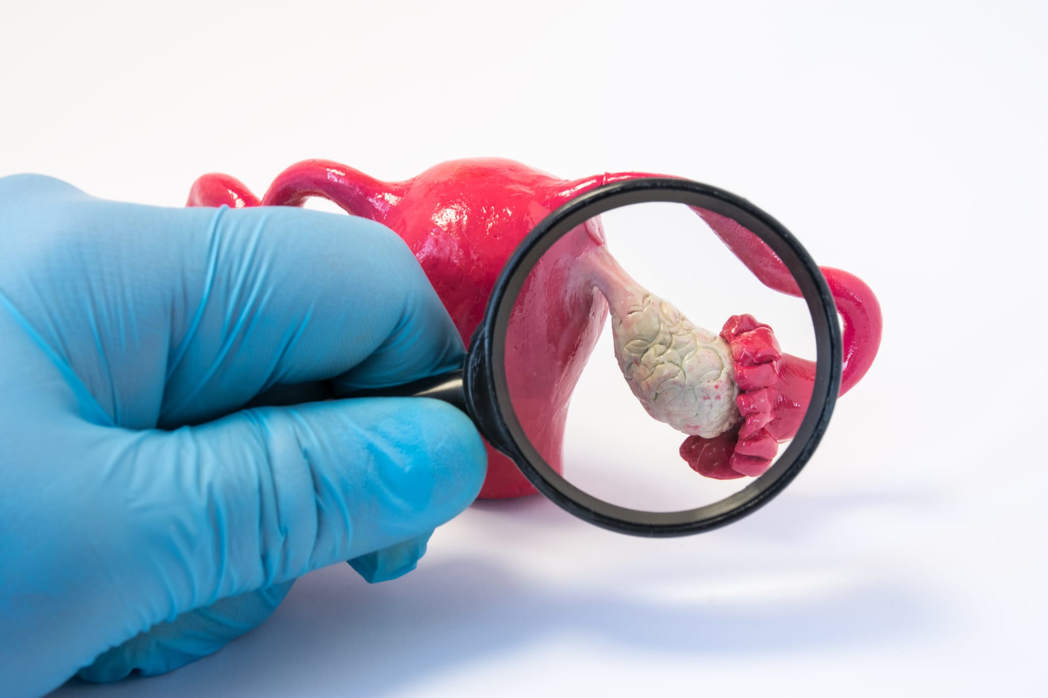 Mercy BioAnalytics Raises $59 Million Series B to Advance Cancer ...