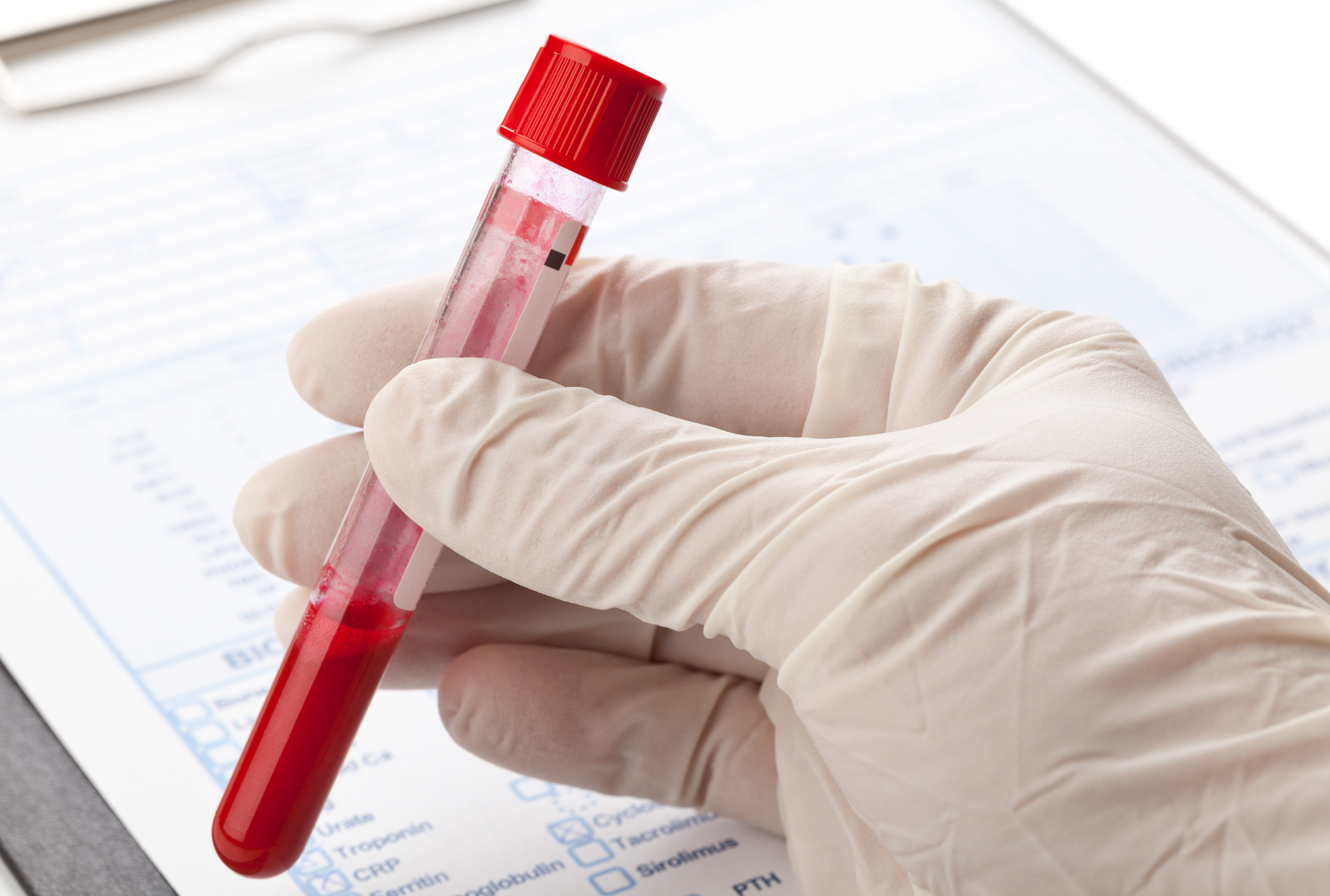 ctDNA Blood Test for Cancer Monitoring Launches in Europe | Clinical ...
