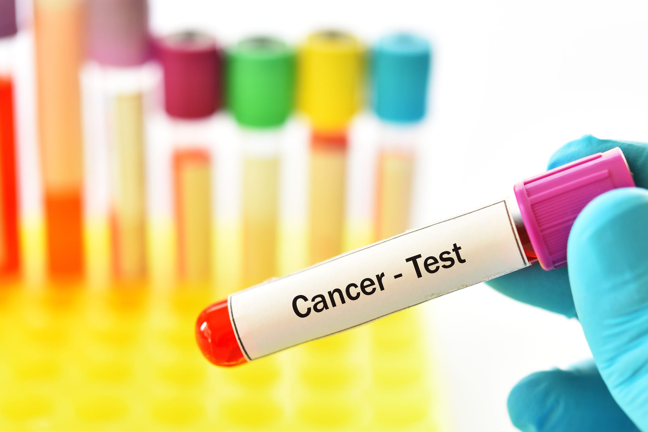 Samsung Invests $110M in GRAIL to Expand Cancer Detection Test in Asia ...