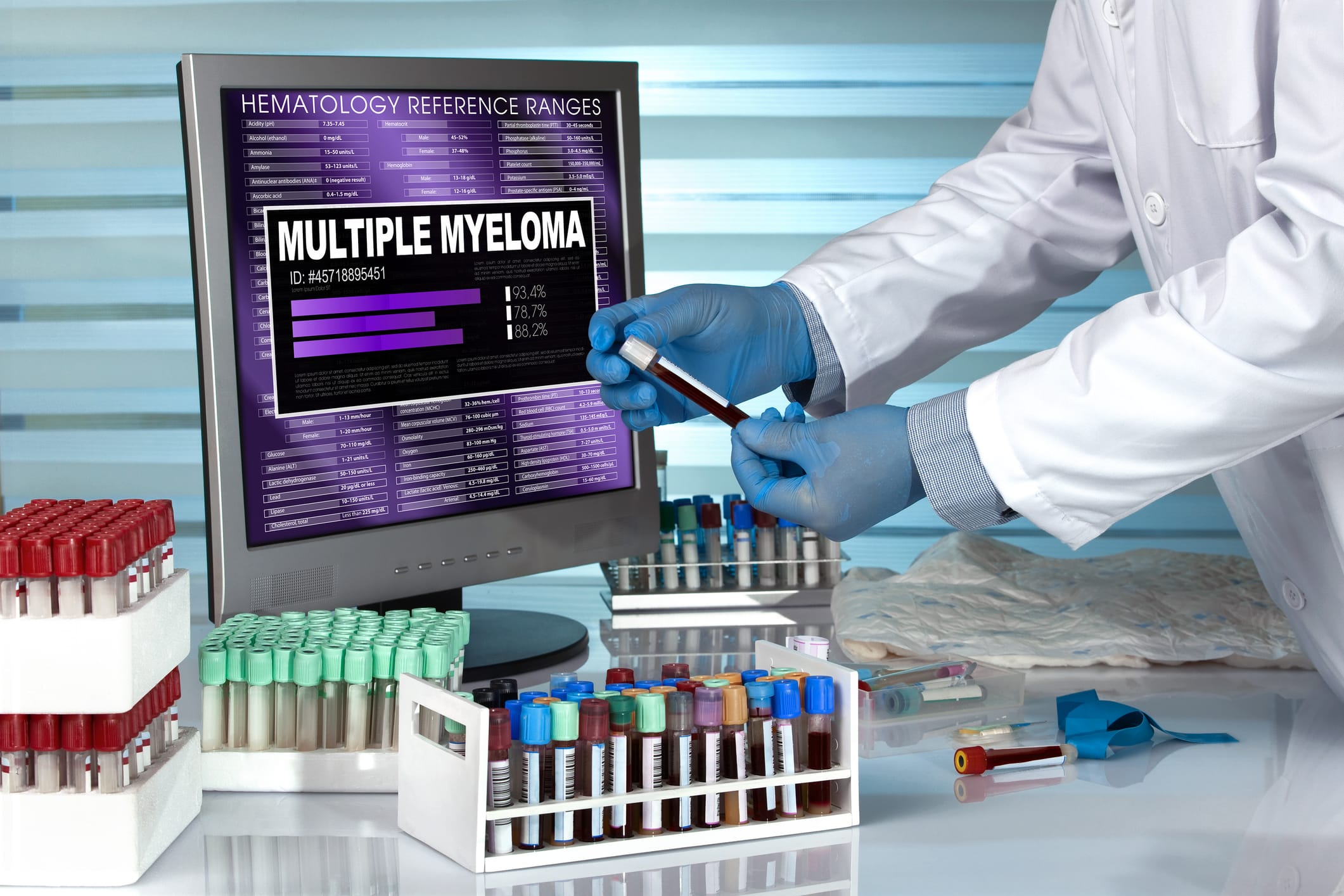 FDA Clears Automated Platform for Multiple Myeloma Diagnosis | Clinical ...