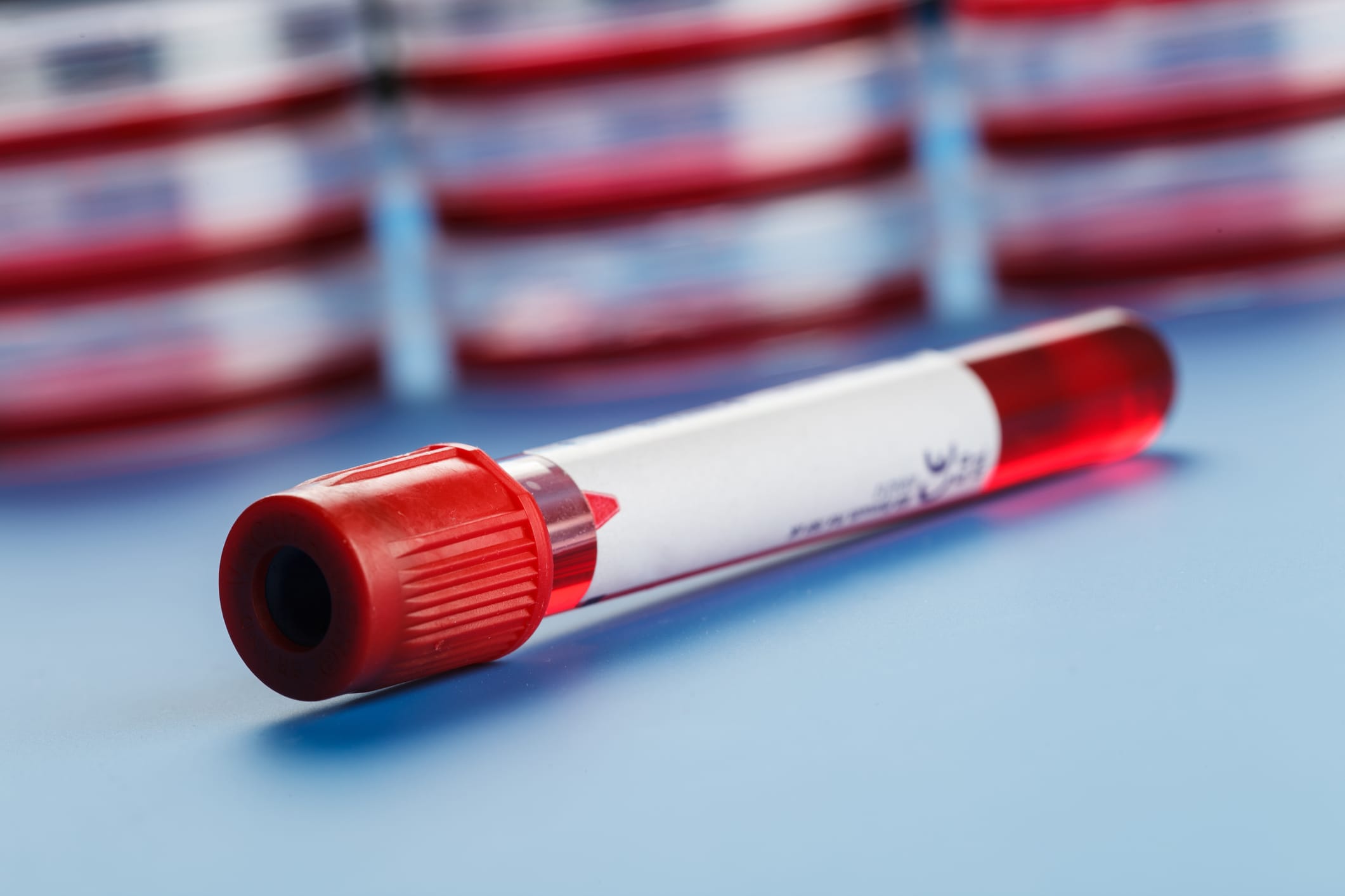 New Data Shows How Plasma Detect Assay May Support Cancer Treatment ...
