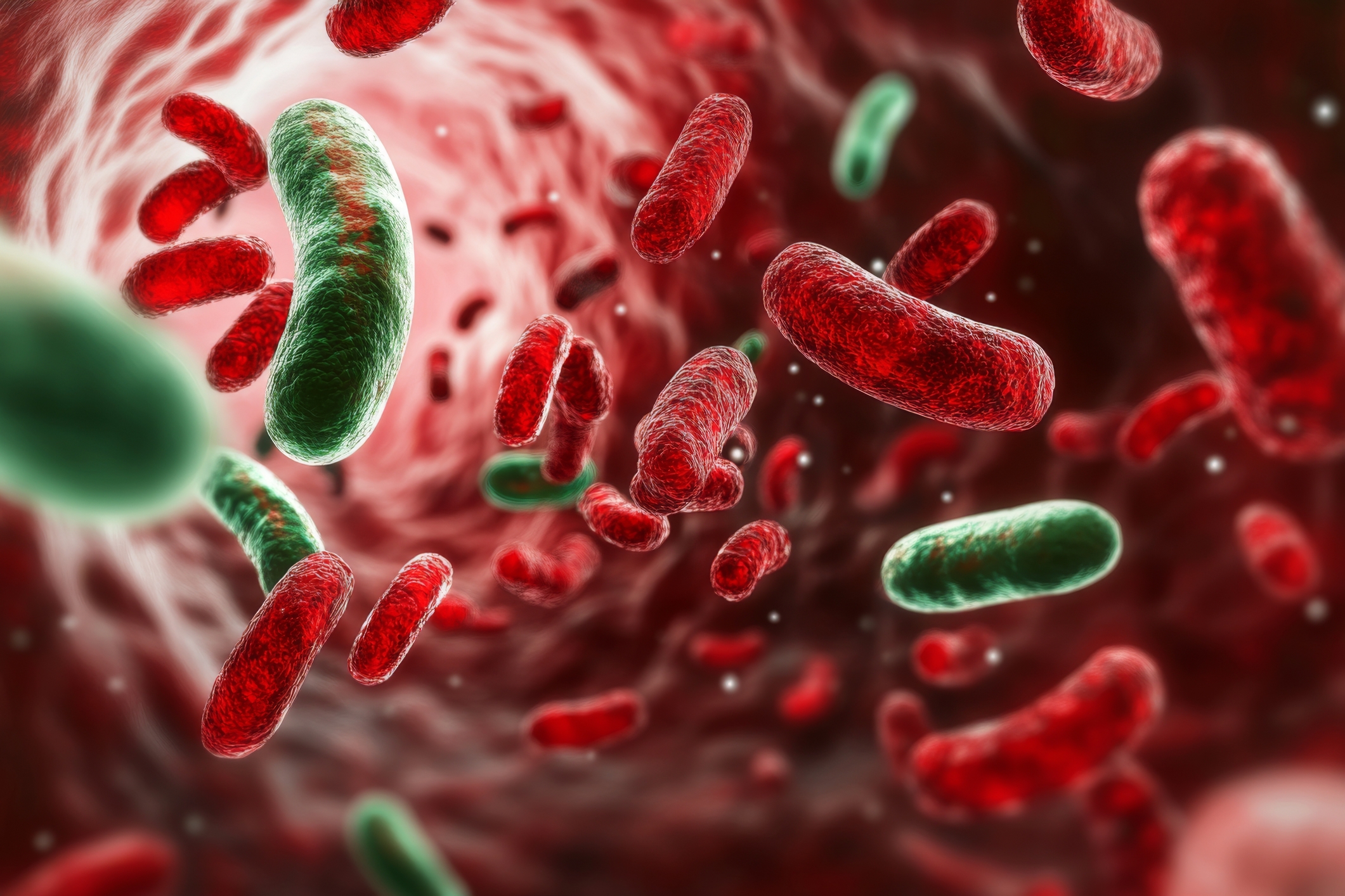 Ocean Dx Sepsis Test Matches Gold Standard in Clinical Study | Clinical ...