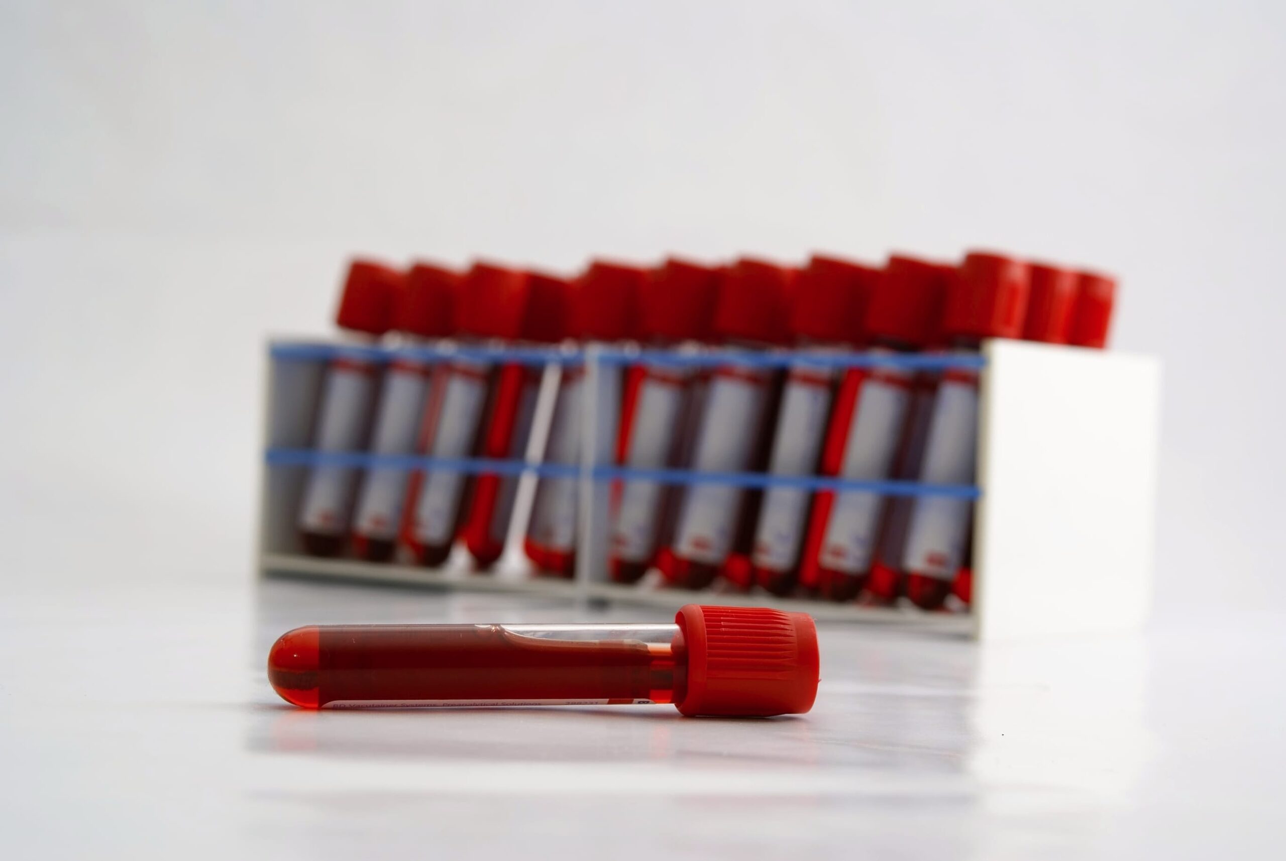 Lab Validates FDA-Cleared Blood-Based Alzheimer's Biomarker Assay Under ...