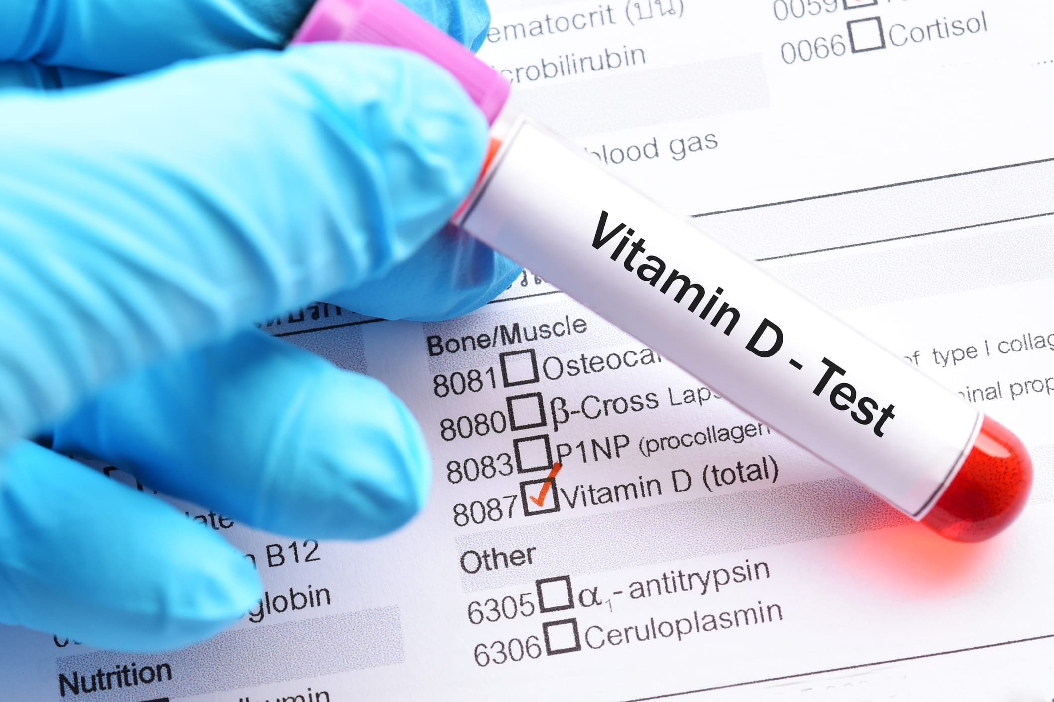 New Study Addresses Measurement Uncertainty in Vitamin D Testing ...