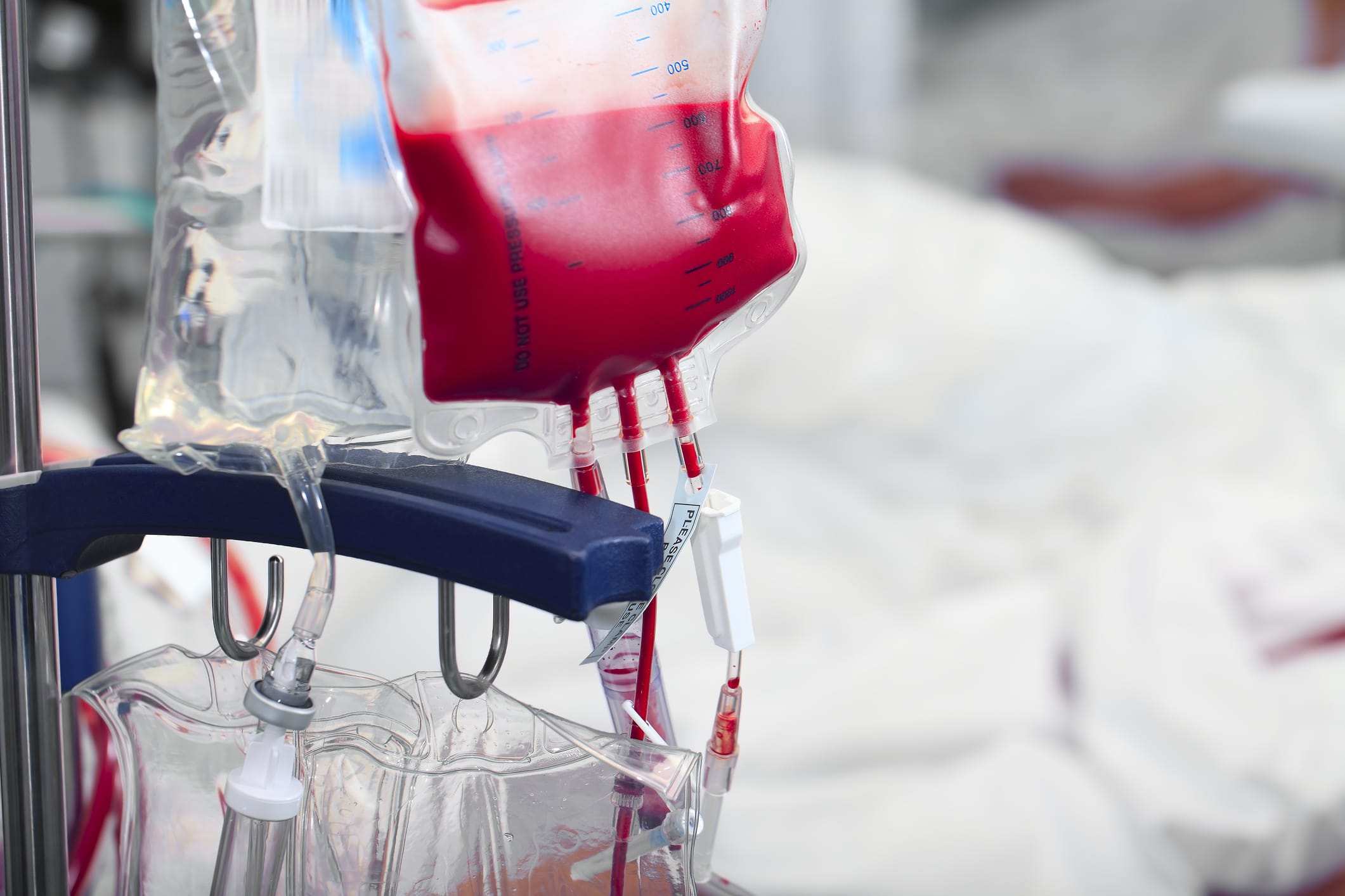 Using Rapid Blood Testing During Surgery to Limit Unnecessary ...