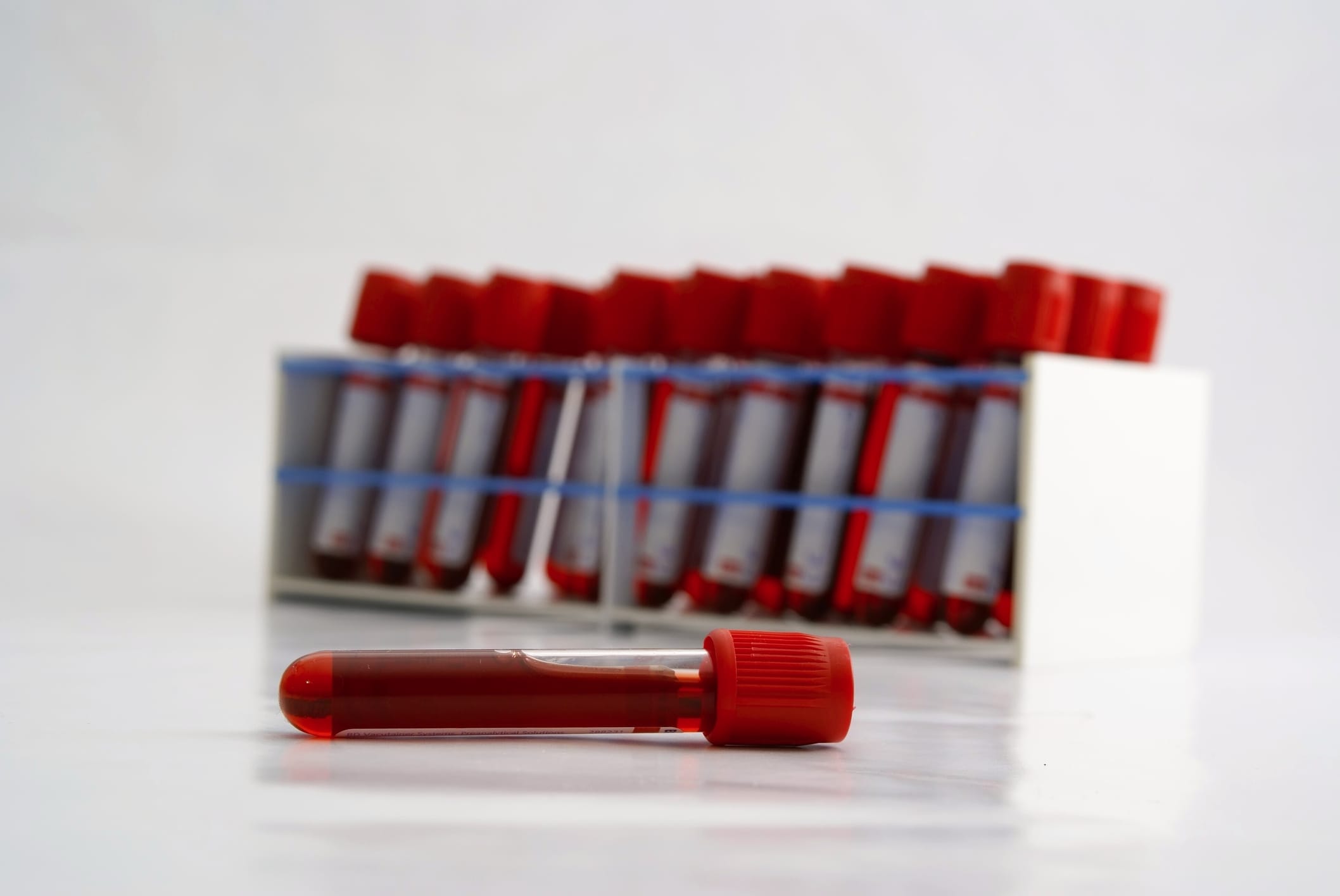 Blood Test Identifies Lung Cancer Patients Who Will Respond to ...