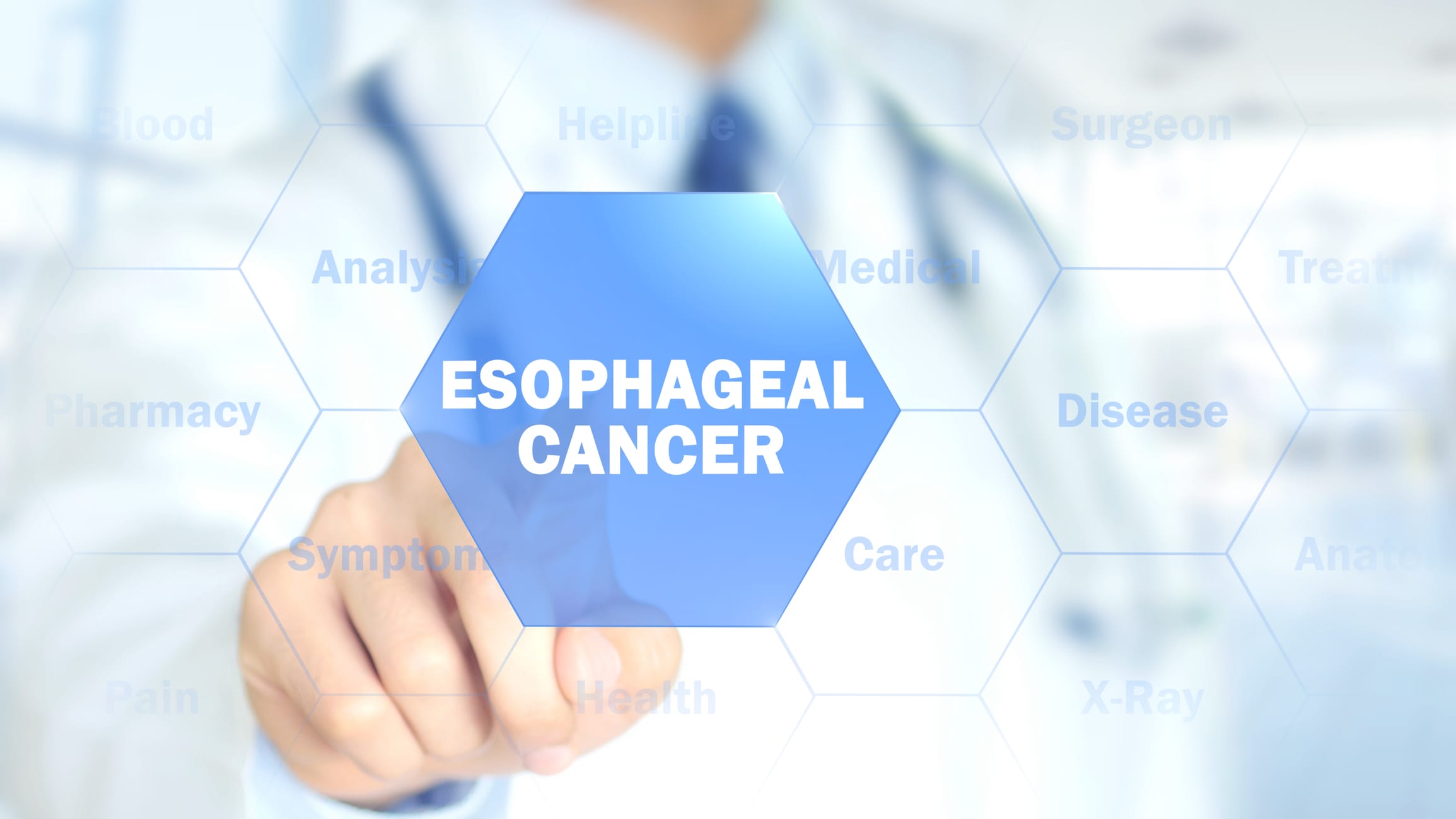 Lucid Diagnostics Secures VA Contract for Esophageal DNA Test ...