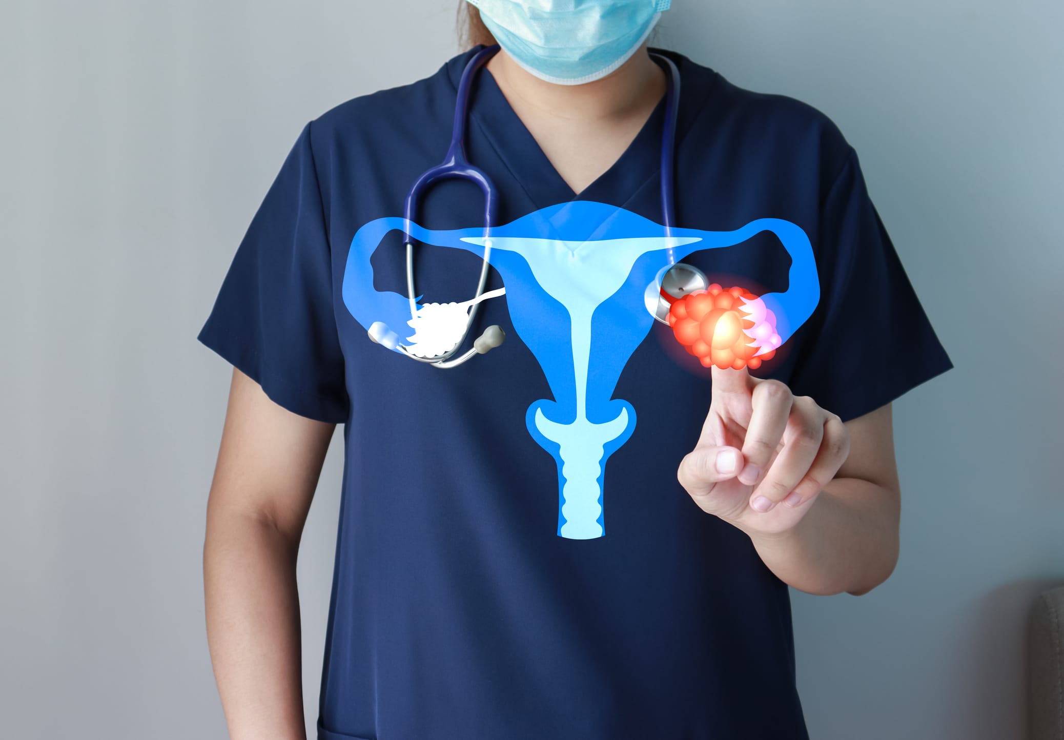 InterVenn Partners with Aranscia to Expand Ovarian Cancer Test Access ...