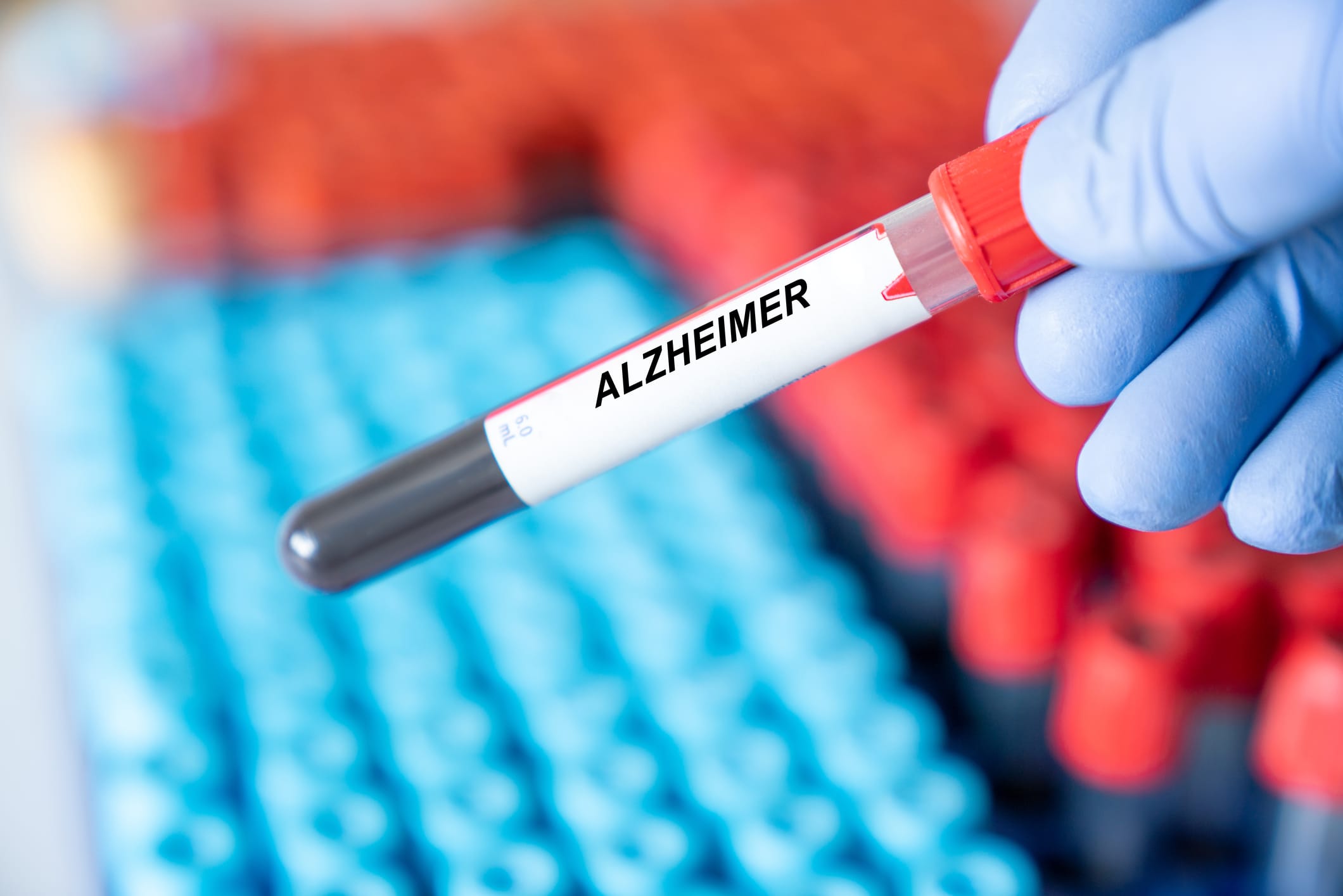 Quanterix Submits FDA 510(k) for Multi-Analyte Alzheimer's Blood Test ...