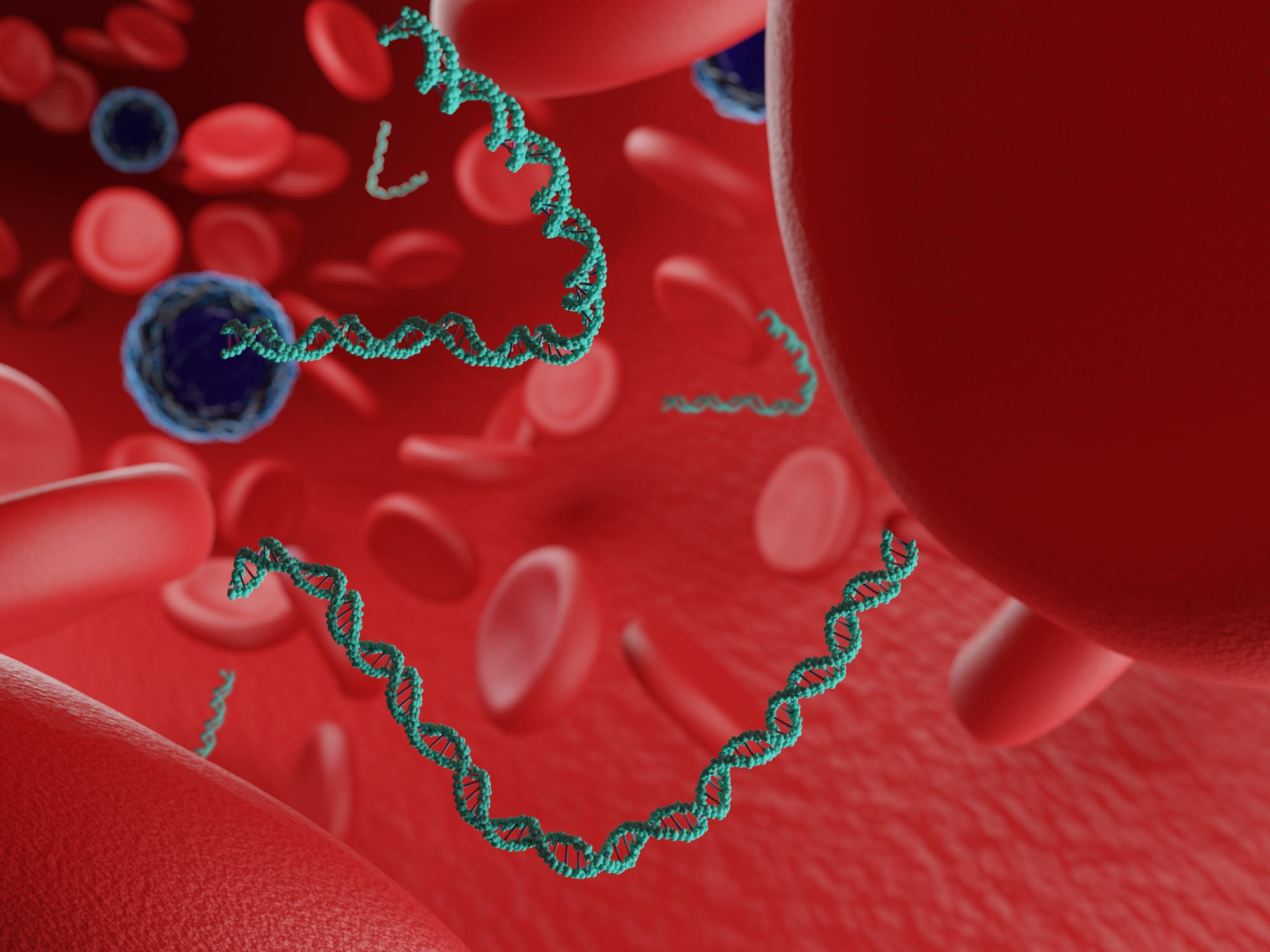 New ctDNA Assay Aims to Detect Molecular Residual Disease Earlier in ...