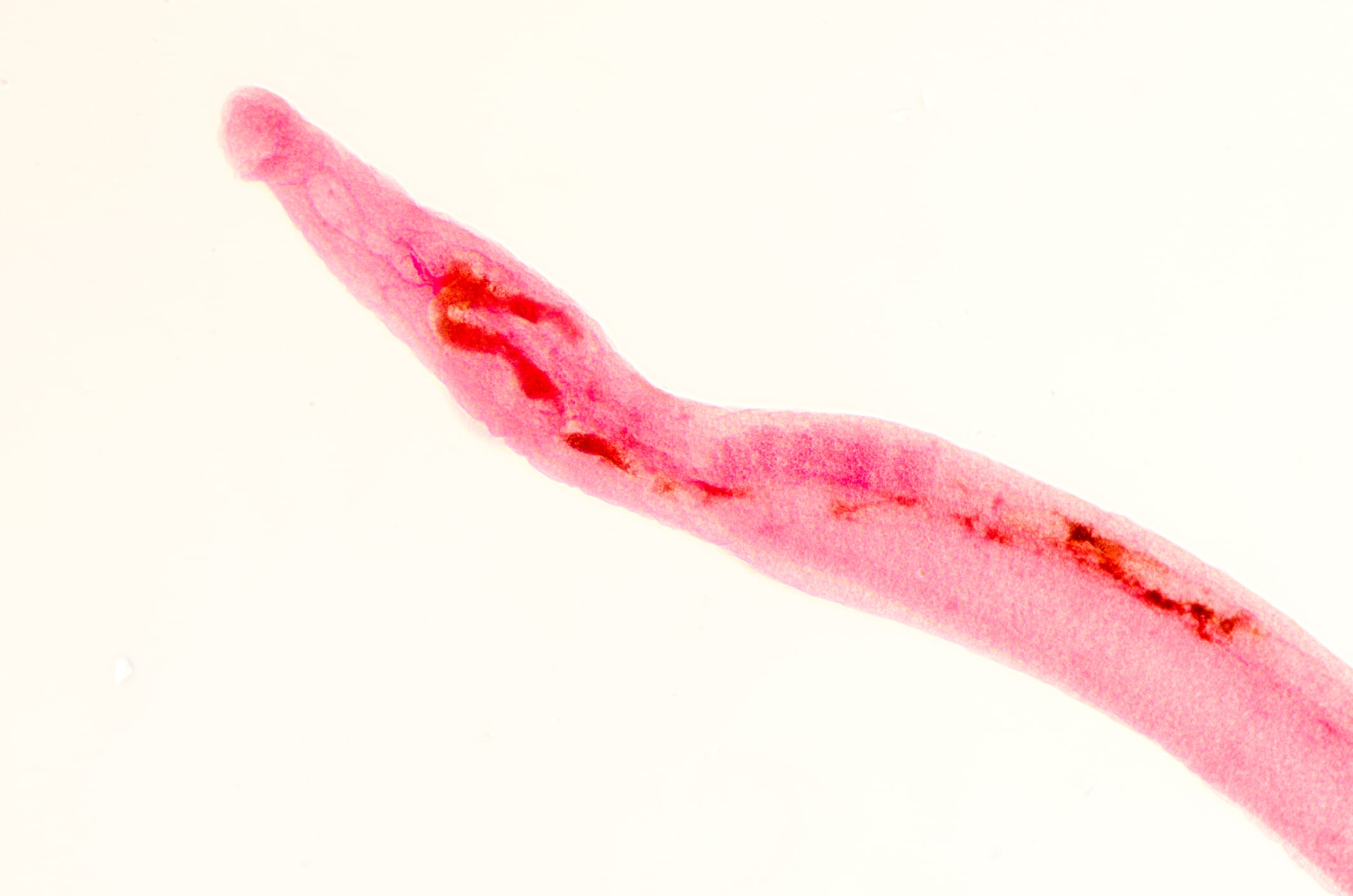 New US Lab Panel Targets Hard-to-Diagnose Liver Fluke Infections ...