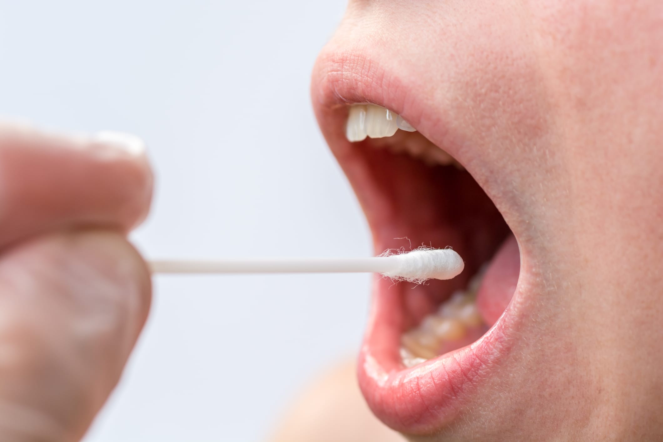 HIV Self-Test Receives Health Canada License | Clinical Lab Products