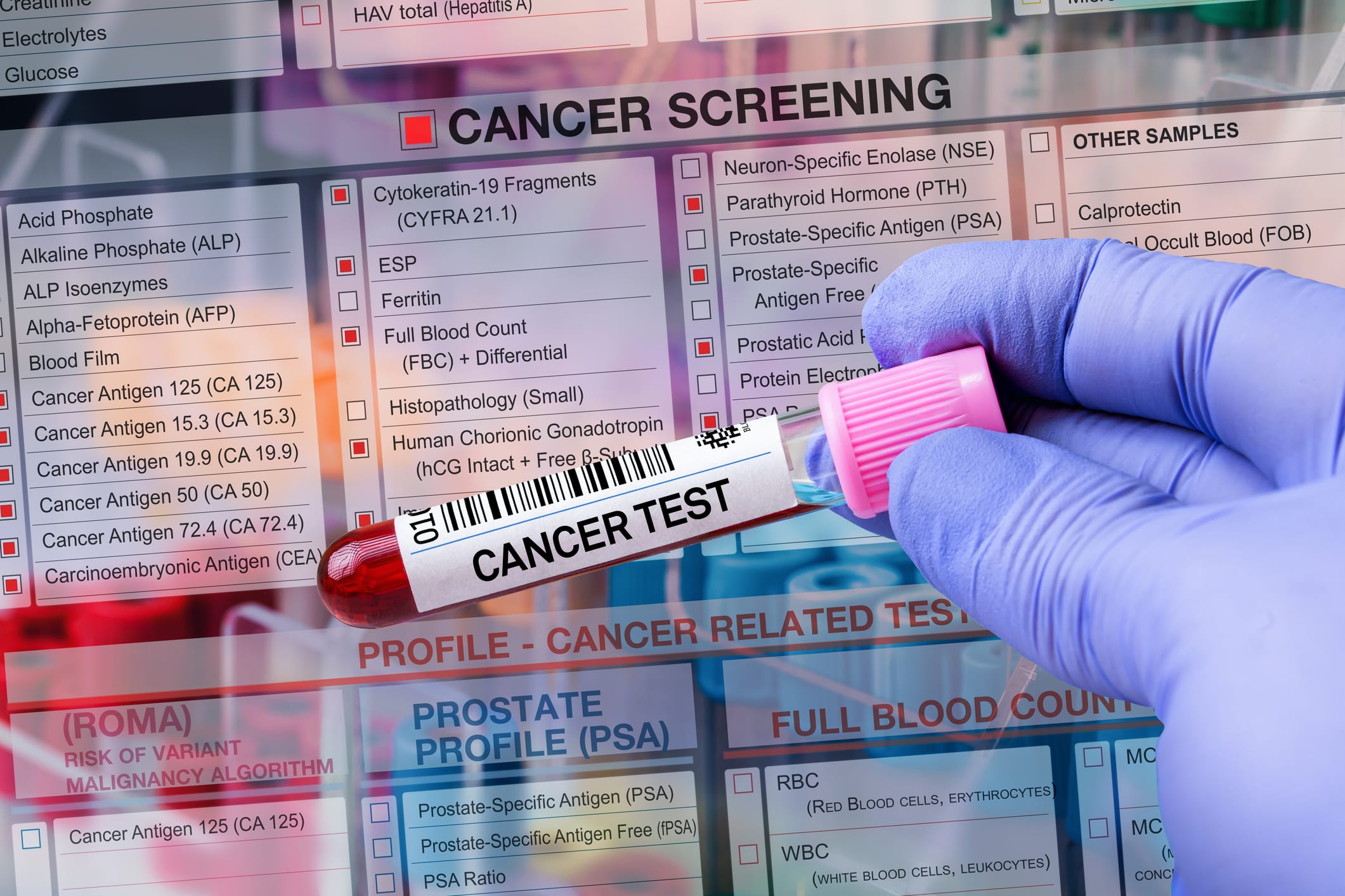 Protein Biomarker Tests May Detect Cancer Earlier Than DNA-Based ...