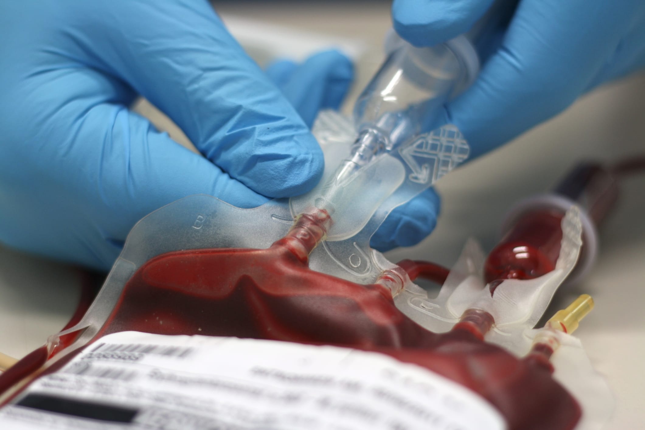 New 4-in-1 Blood Donor Screening Assay Targets HIV, Hepatitis B, C, and ...