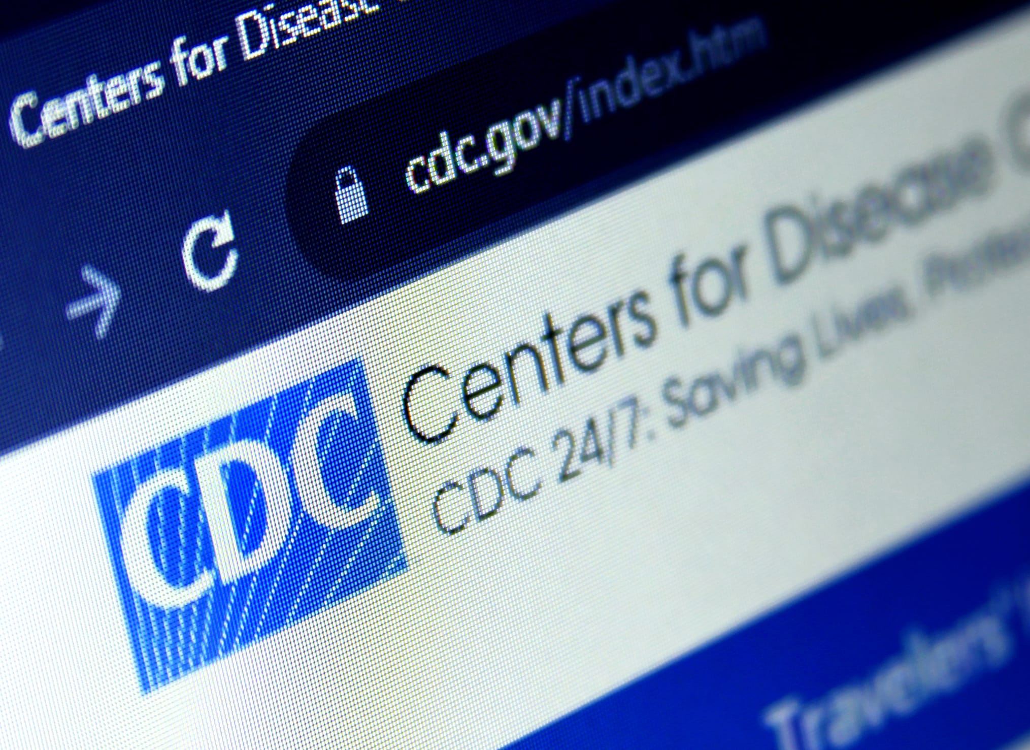 CDC Lists Dozens of Infectious Disease Tests as Unavailable in Lab ...