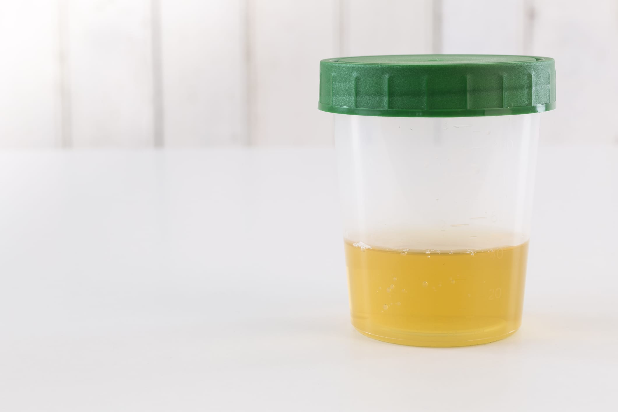 Labcorp's FDA-Cleared Rapid Fentanyl Urine Test Launches | Clinical Lab ...