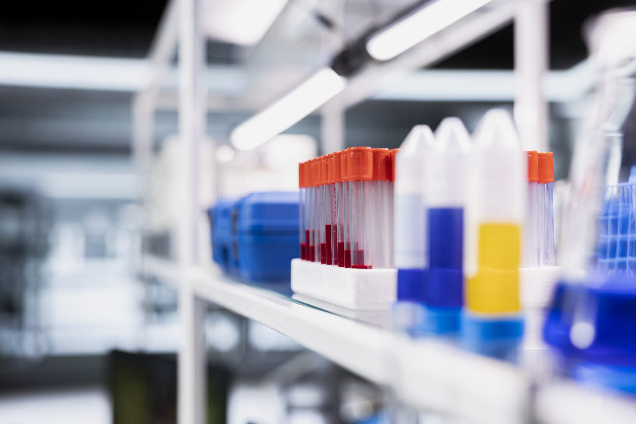 New Blood Test Detects Active and Infectious Tuberculosis | Clinical ...